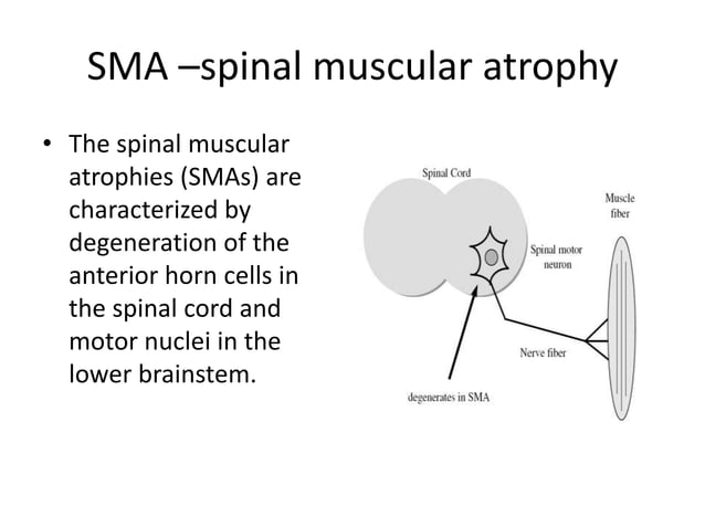 Spinal muscle atrophy SMA: make it easy | PPTX