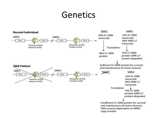 Spinal muscle atrophy SMA: make it easy | PPTX