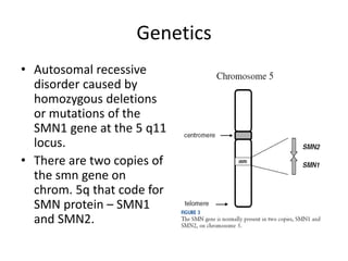 Spinal muscle atrophy SMA: make it easy | PPTX