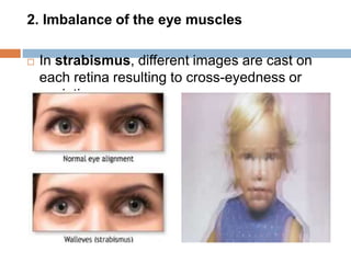 Students Who are Blind or Have Low Vision | PPTX
