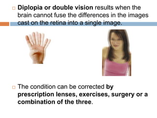 Students Who are Blind or Have Low Vision | PPTX