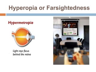 Students Who are Blind or Have Low Vision | PPTX