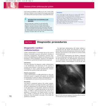 Guides on Heart Disease | PDF