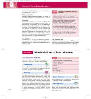 Guides on Heart Disease | PDF