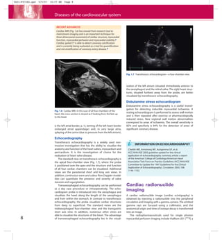 Guides on Heart Disease | PDF