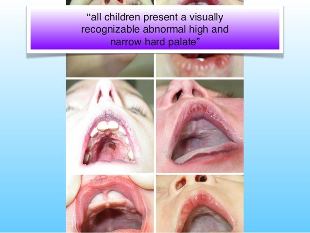 Studies evidence asof oct 2013
