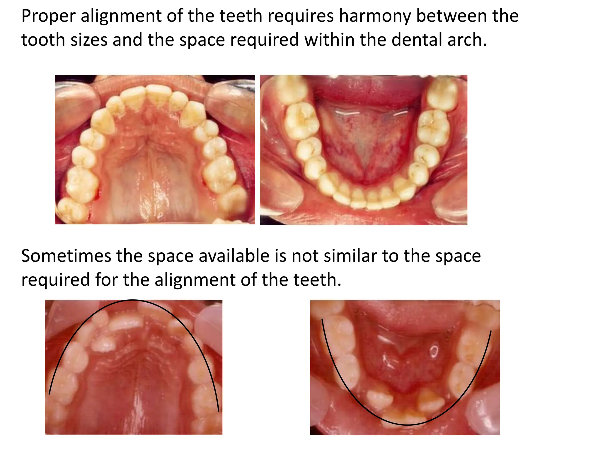 Study Cast Analysis Lac for 4th level1 .pptx