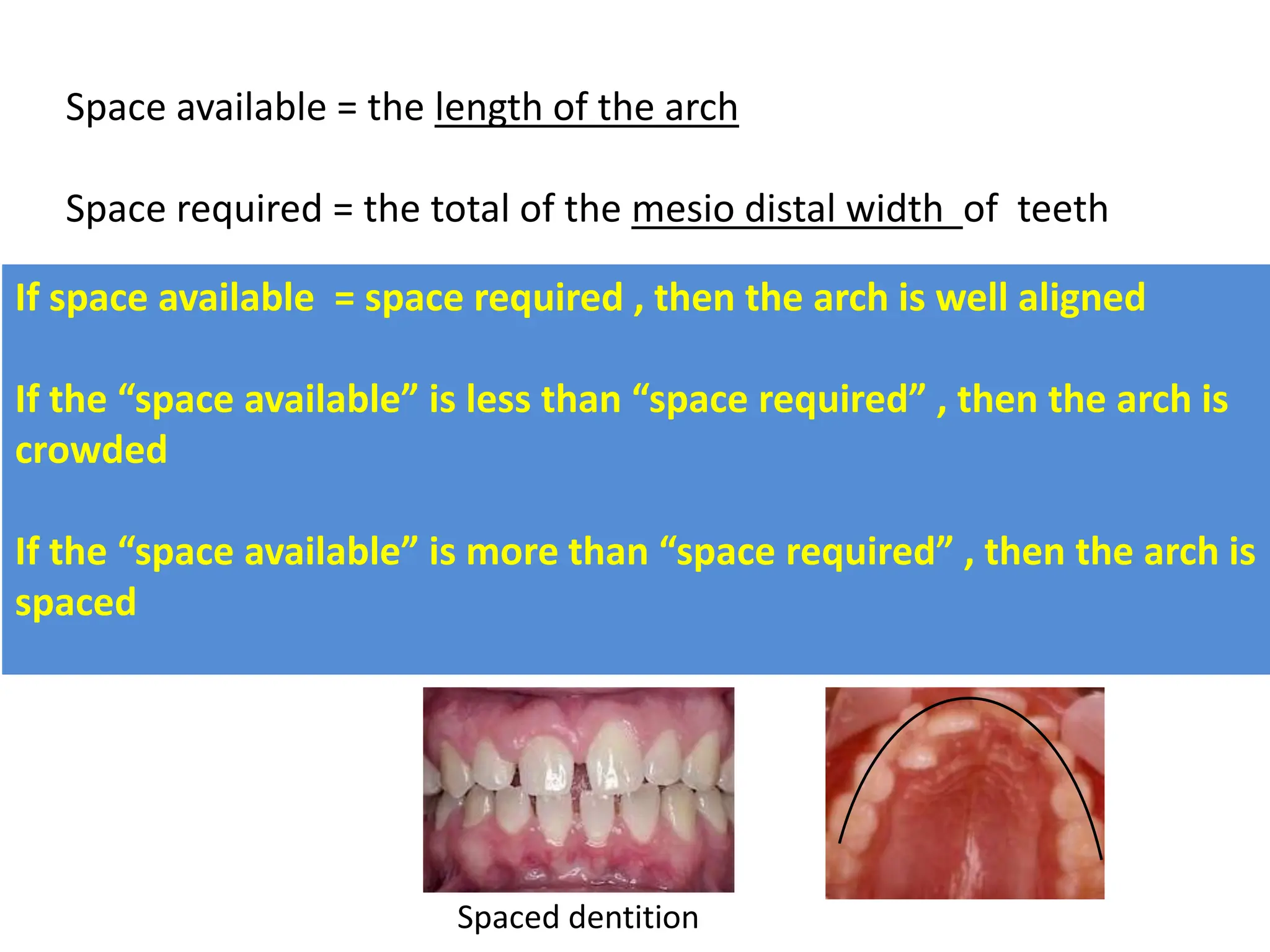 Study Cast Analysis Lac for 4th level1 .pptx