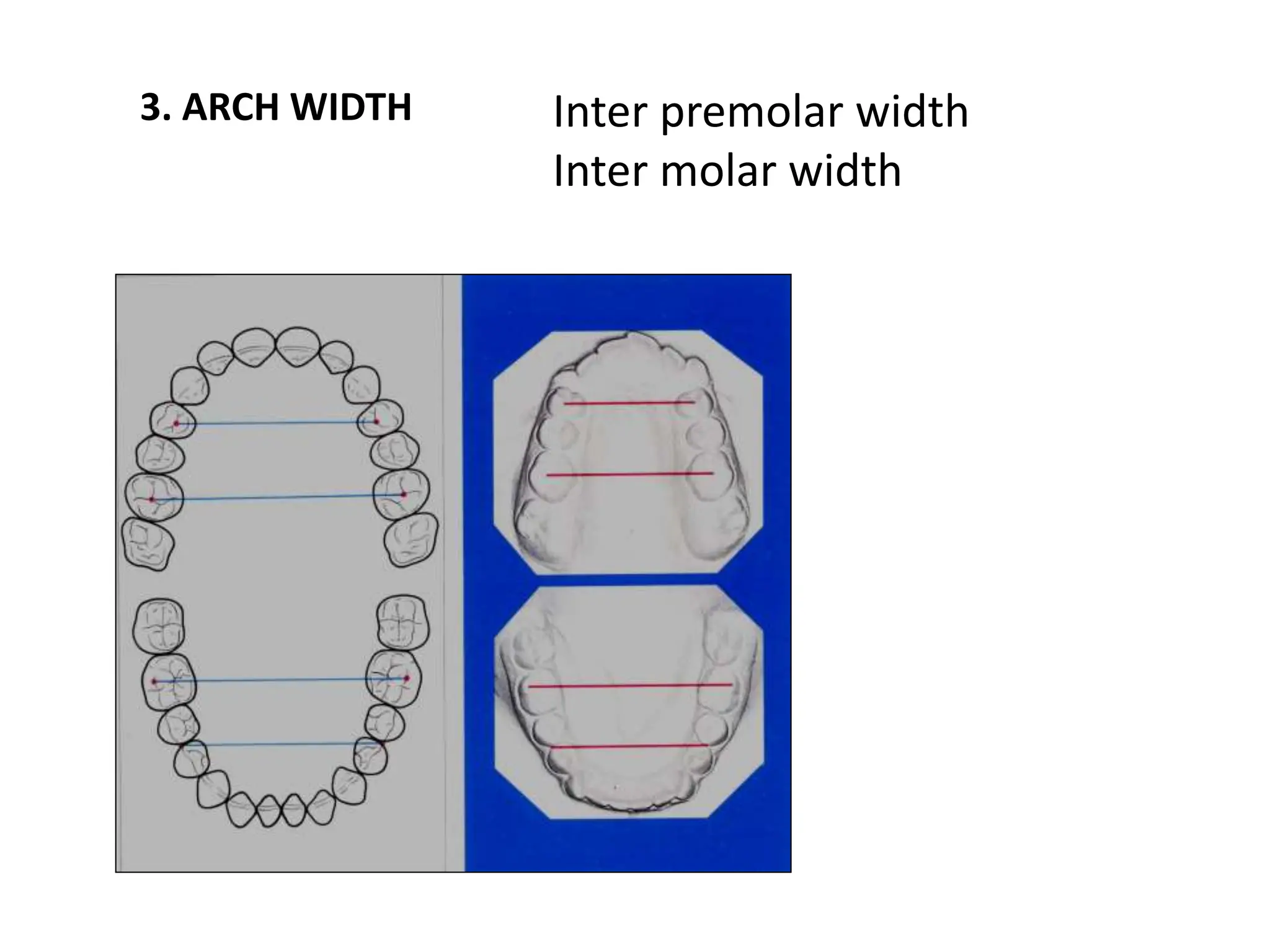 Study Cast Analysis Lac for 4th level1 .pptx | Free Download