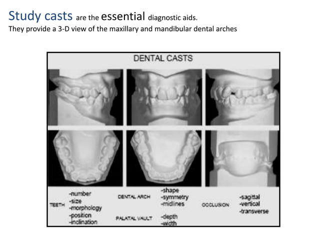 Study Cast Analysis Lac for 4th level1 .pptx