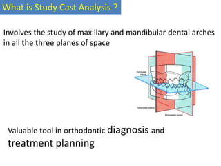 Study Cast Analysis Lac for 4th level1 .pptx