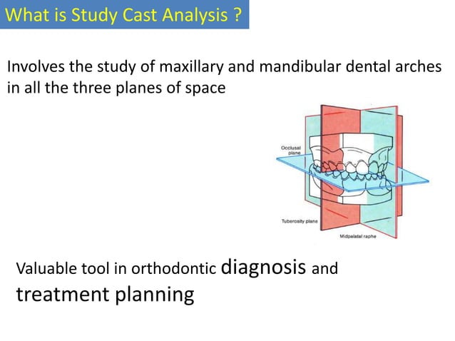 Study Cast Analysis Lac for 4th level1 .pptx