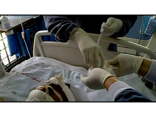 effectiveness of mechanical vibrator for chest physiotherapy in ...