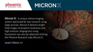 Studying Retinal Function in Large Animals: Laser-Induced Choroidal ...