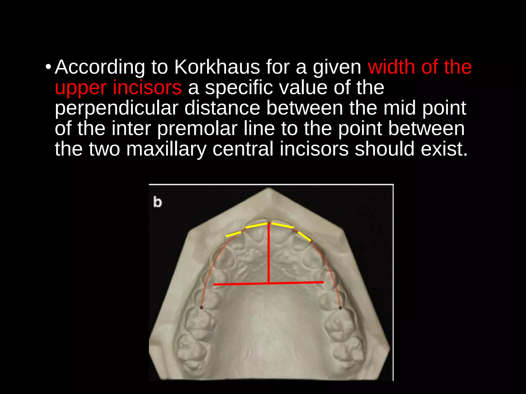 Model analysis in orthodontic | PPT