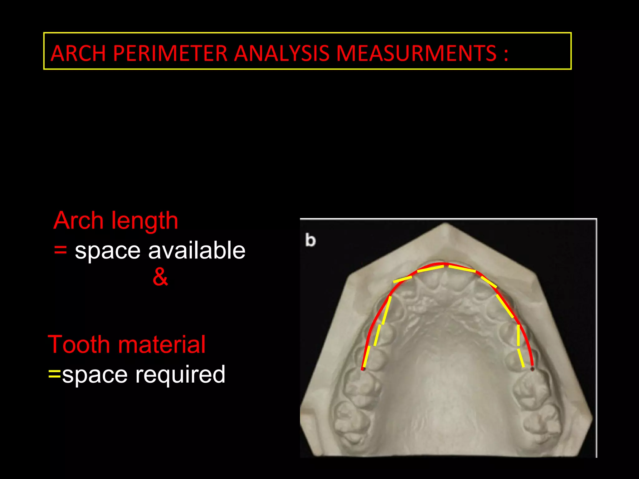 Model analysis in orthodontic | PPT