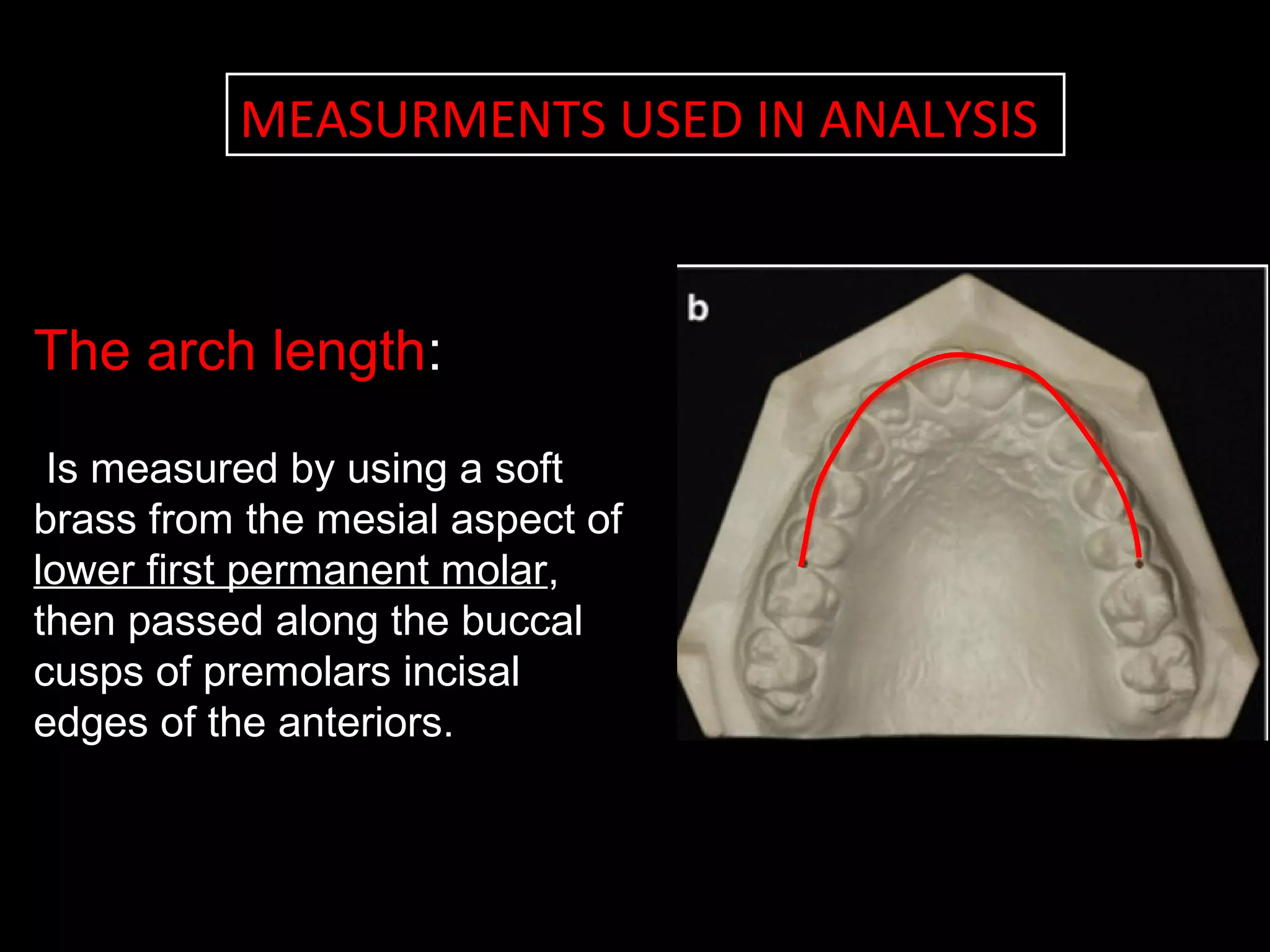 Model analysis in orthodontic | PPT
