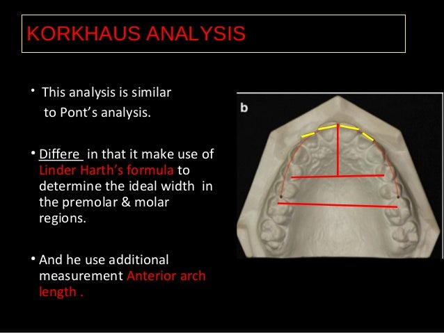 Model Analysis In Orthodontic