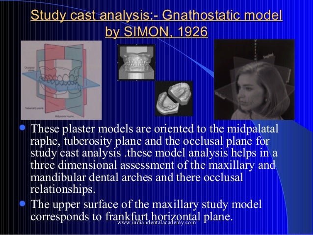 Study models /certified fixed orthodontic courses by Indian dental ac…