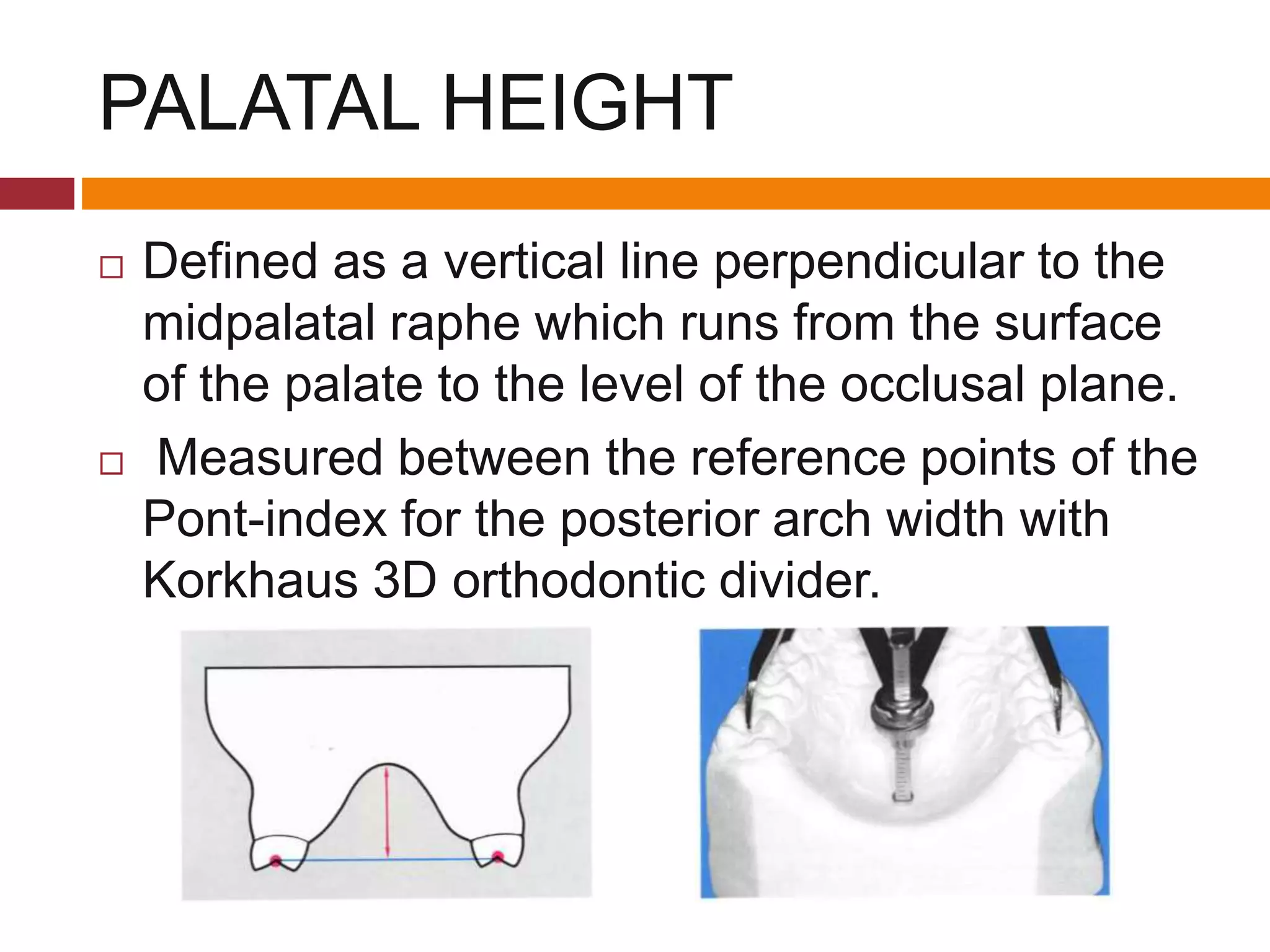 Study models in Orthodontics | PPTX
