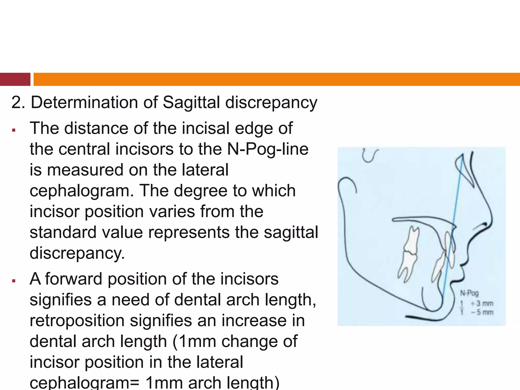 Study models in Orthodontics | PPTX