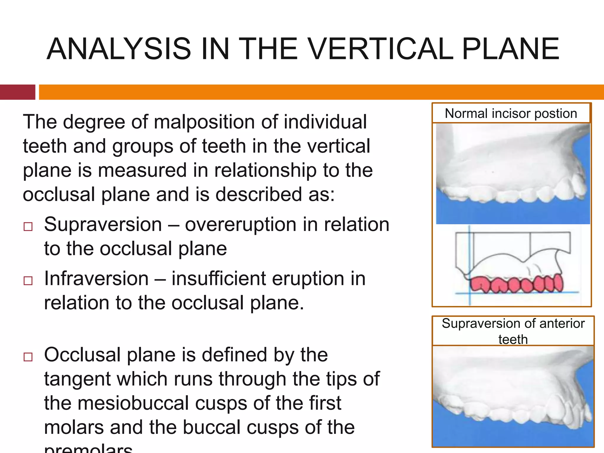 Study models in Orthodontics | PPTX
