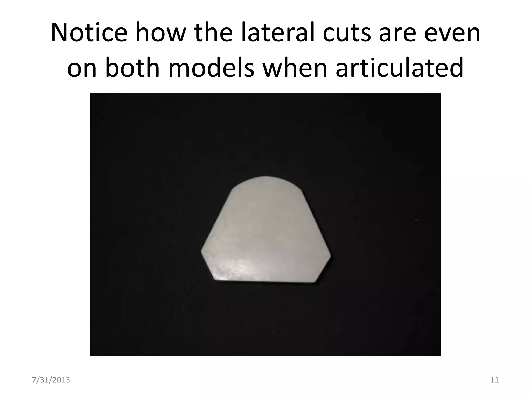 Study models 101 trimming | PPTX