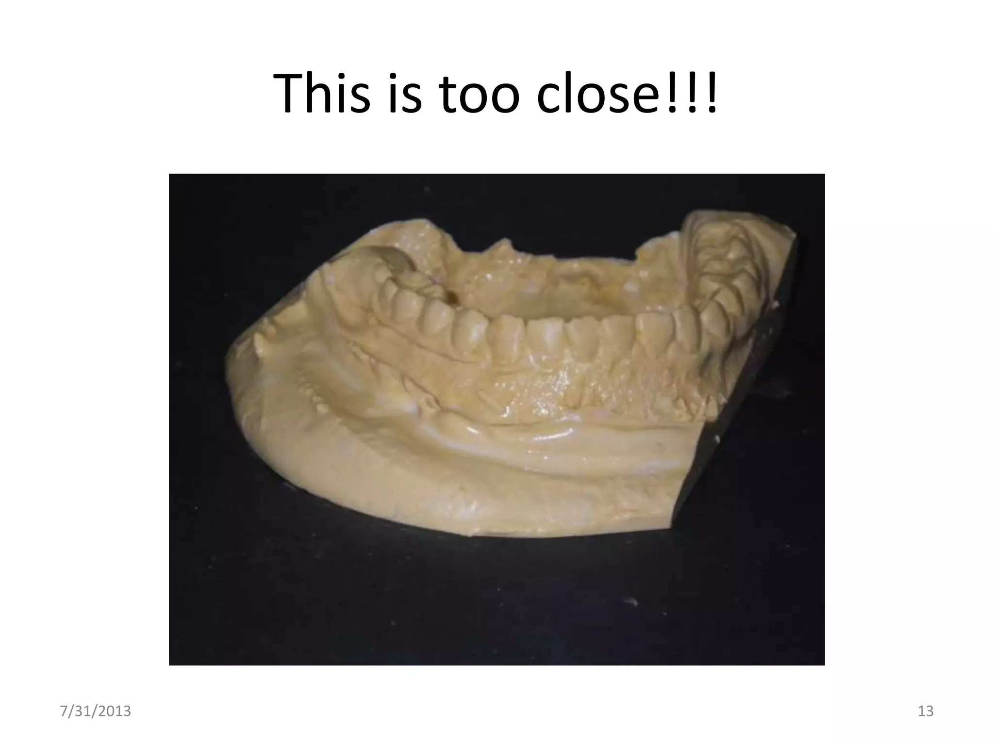 Study models 101 trimming | PPTX