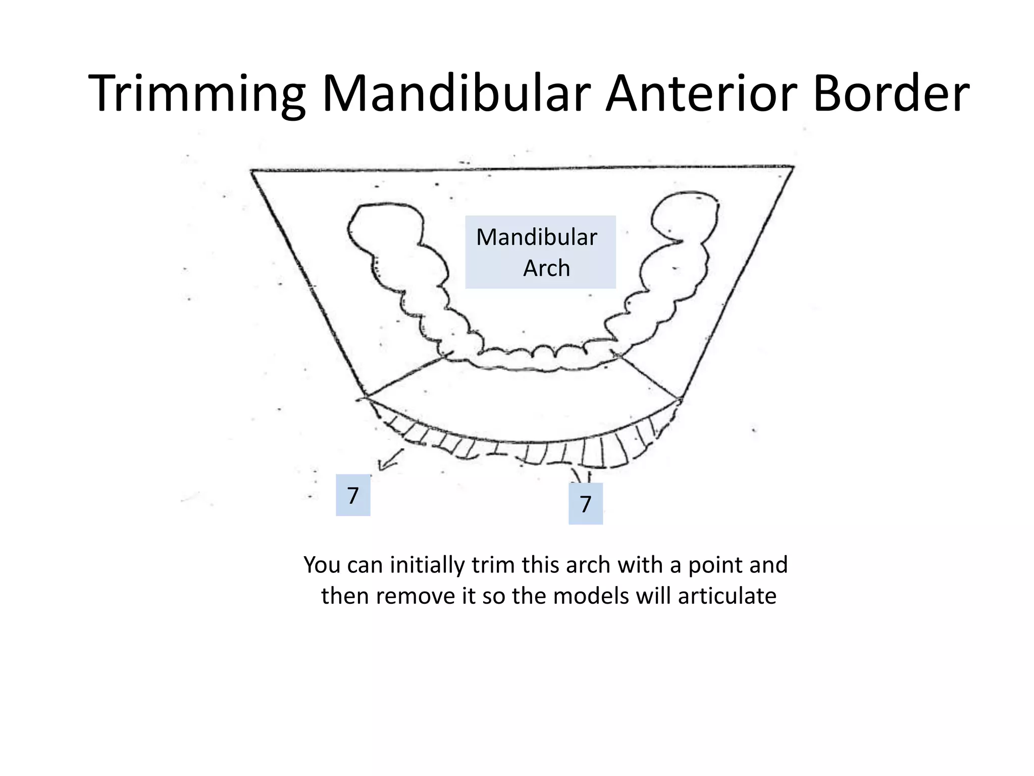 Study models 101 trimming | PPTX