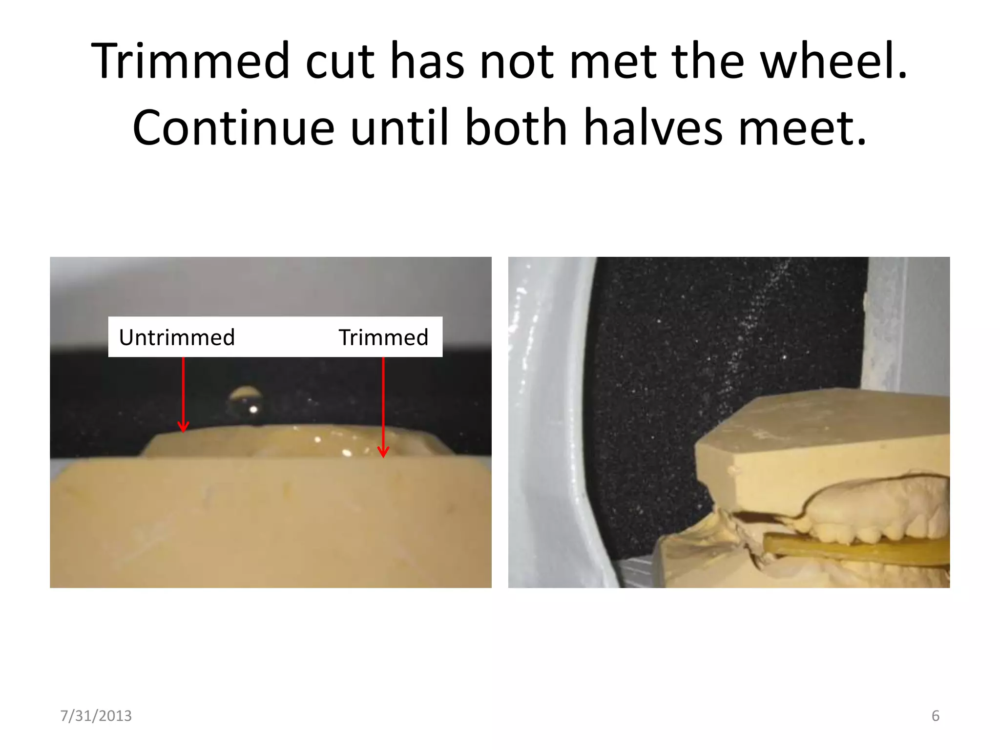 Study models 101 trimming | PPTX