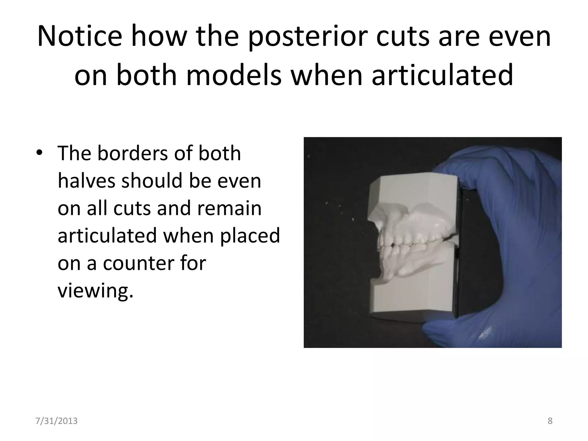 Study models 101 trimming | PPTX