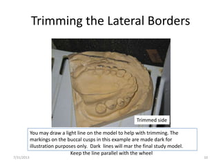 Study models 101 trimming | PPTX
