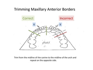 Study models 101 trimming | PPTX
