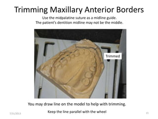 Study models 101 trimming | PPTX