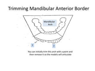 Study models 101 trimming | PPTX
