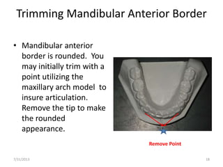 Study models 101 trimming | PPTX