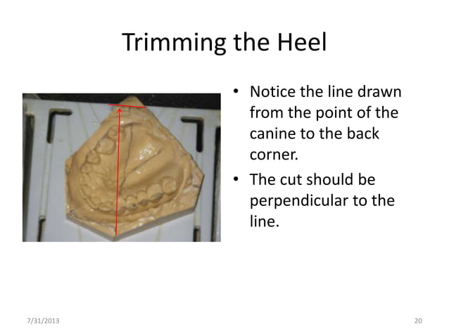 Study models 101 trimming | PPT