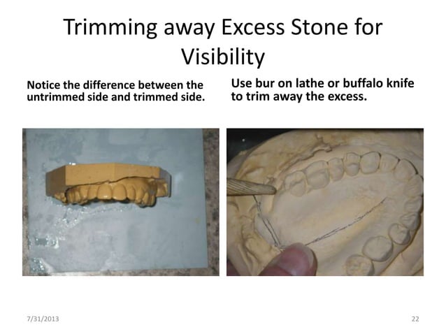 Study models 101 trimming | PPTX | Dental Health | Diseases and Conditions