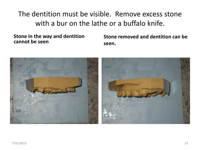 Study models 101 trimming | PPTX | Dental Health | Diseases and Conditions