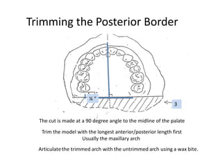 Study models 101 trimming | PPT