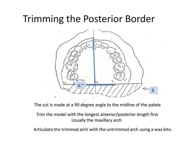 Study models 101 trimming | PPTX | Dental Health | Diseases and Conditions