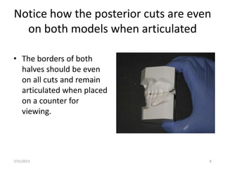 Study models 101 trimming | PPTX