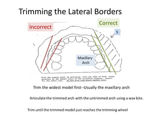 Study models 101 trimming | PPTX