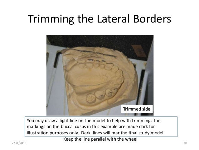 Study models 101 trimming