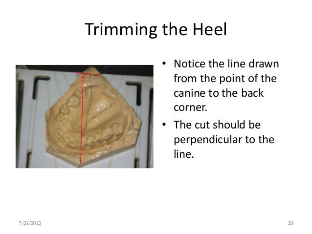 Study models 101 trimming