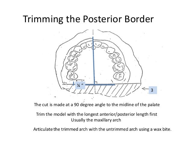Study models 101 trimming