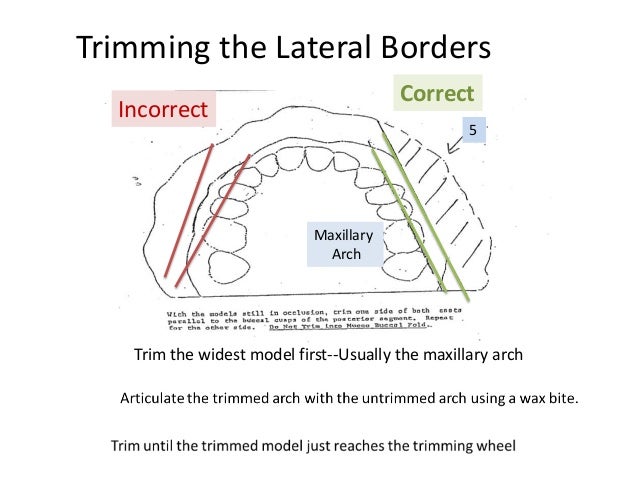 Study models 101 trimming