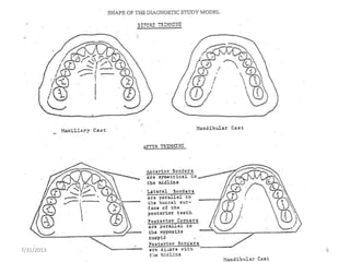 Study models 101 views | PPT
