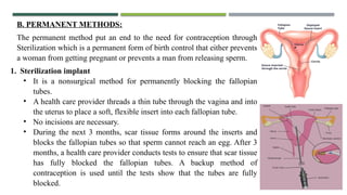 STUDY OF FAMILY PLANNING DEVICES .pptx