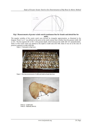 Study of Greater Sciatic Notch in Sex Determination of Hip Bone by ...